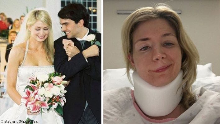 Stroke Leaves Gorgeous 26-Yr-Old With Paralyzed Face—10 Yrs Later, Her ...