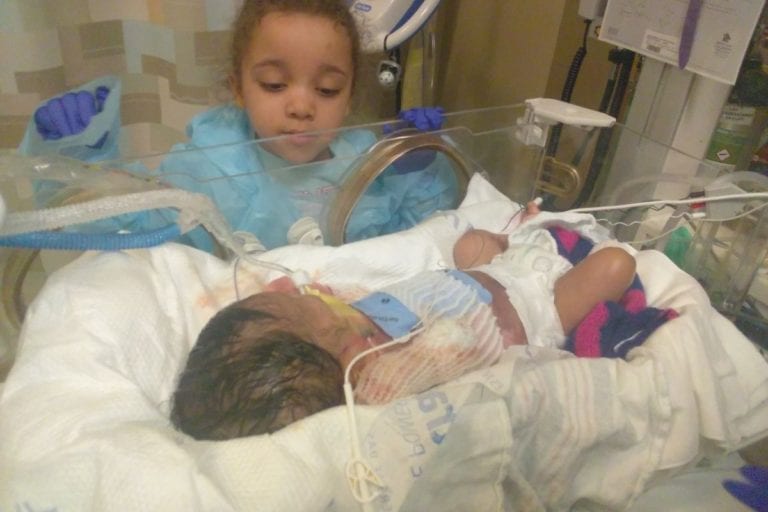 Baby Born Without Skin Baffled Doctors for Some Time