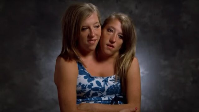 Inspiring Unity: The Remarkable Story of Conjoined Twins Abby ...
